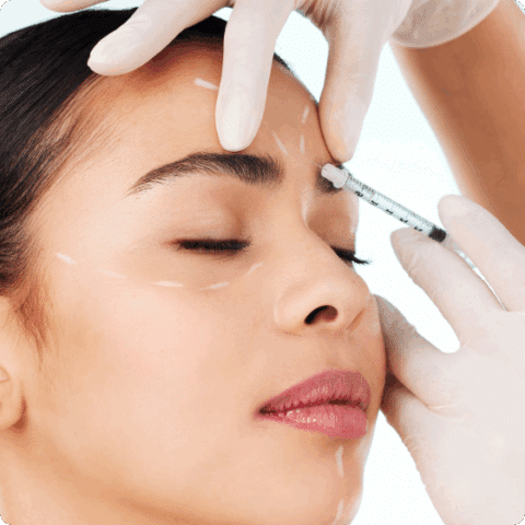 Glabella Botox - Quick Aesthetics Med Spa