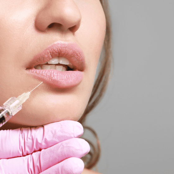 Lip Flip Botox Plano, TX | Natural Lip Pout Enhancement